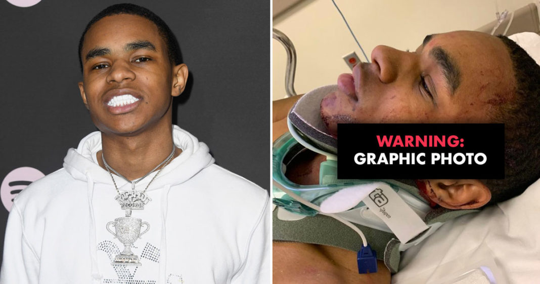 YBN Almighty Jay Needed 300 Stitches After Being Stabbed in the Face ...